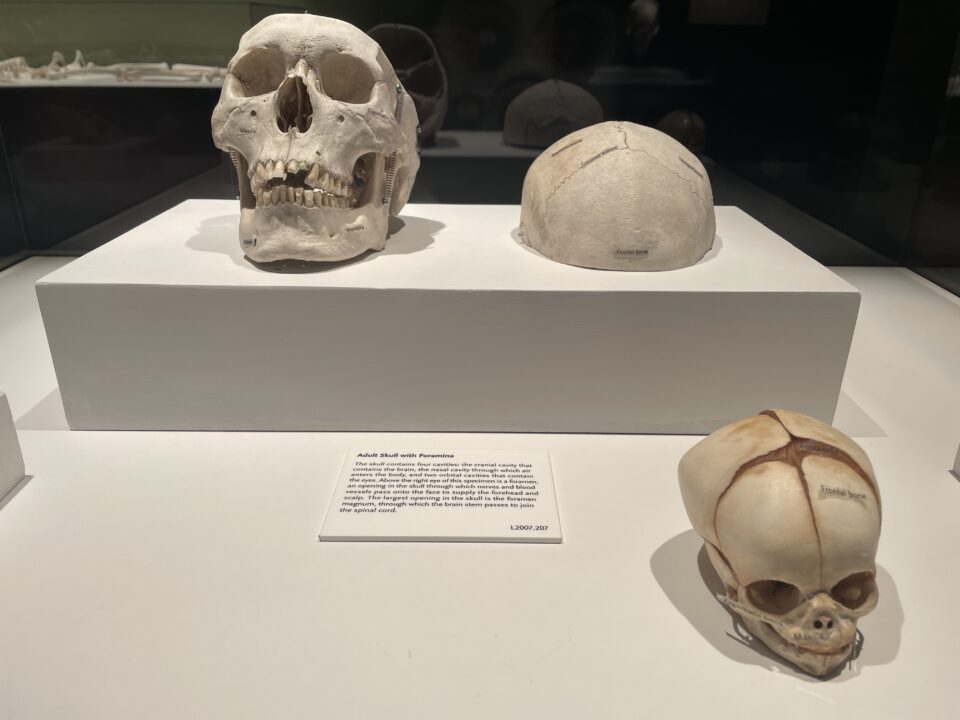 Review of Bodies... The Exhibition at Luxor - Look Inside!