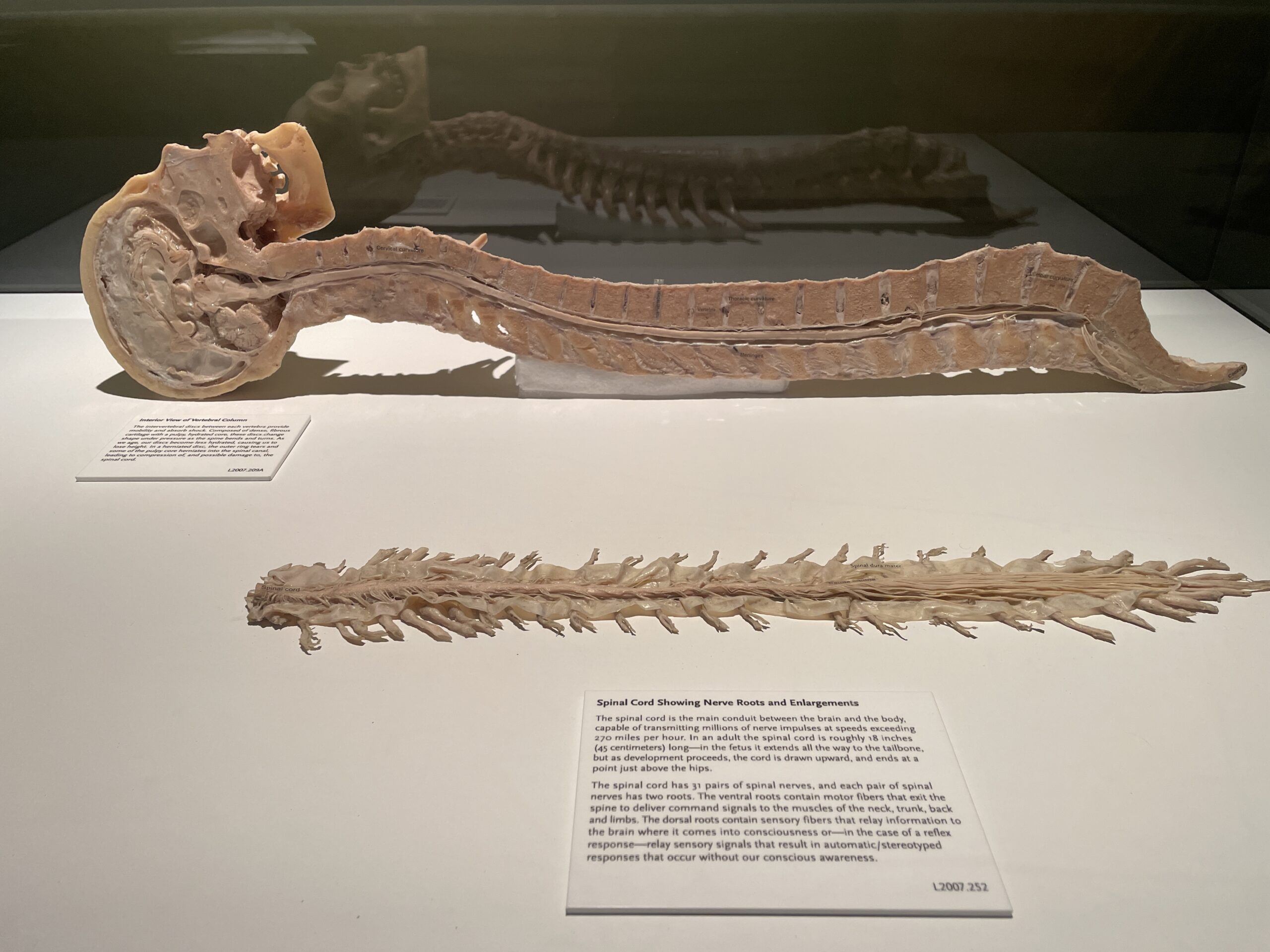 Review of Bodies... The Exhibition at Luxor - Look Inside!