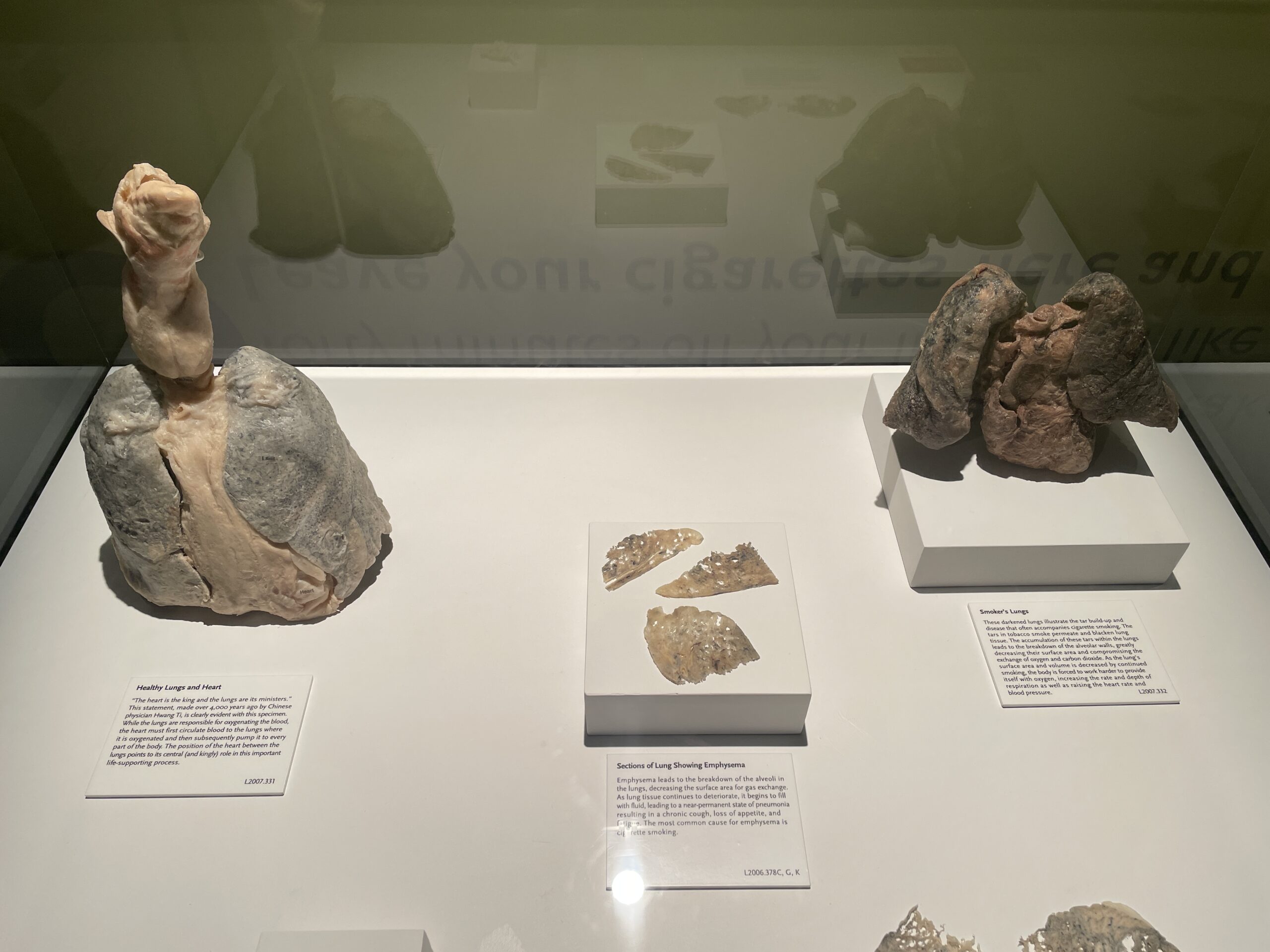 Review of Bodies... The Exhibition at Luxor - Look Inside!